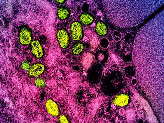 Clinical Trial Evaluating Monkeypox Vaccine Begins | HIV.gov